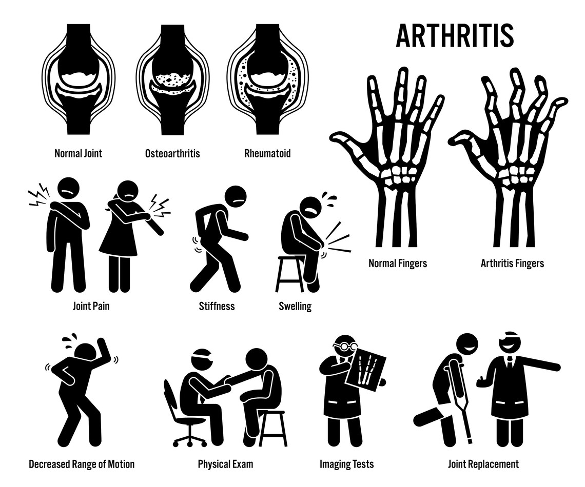 Arthritis Joint Pain Joint Disease Signs Symptoms Diagnosis - Etsy