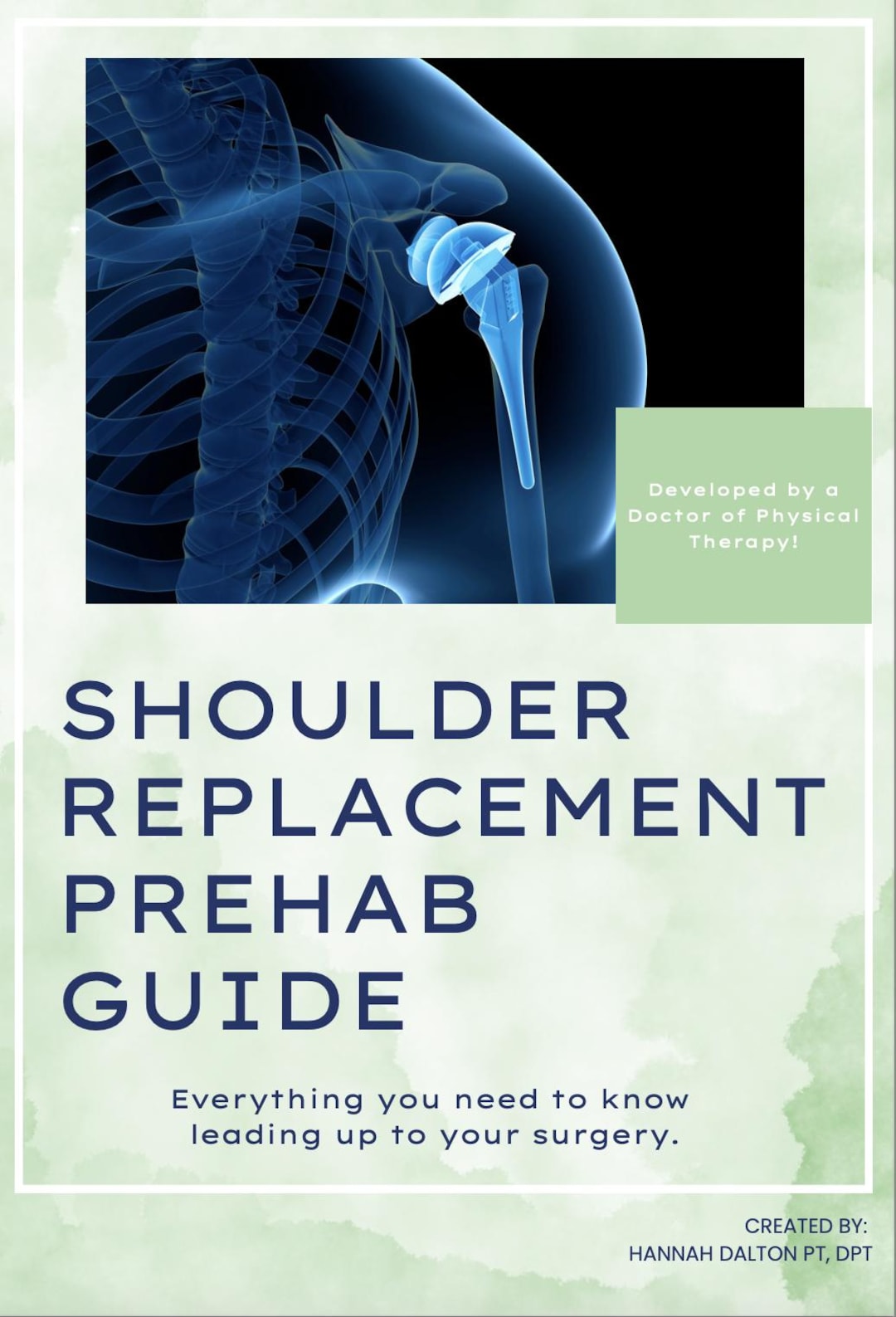 Shoulder Replacement Prehab Guide - PT Approved Exercises & Pre-surgery ...