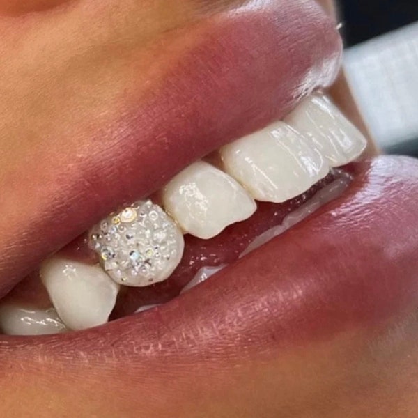 Chandelier Tooth Gems - Etsy