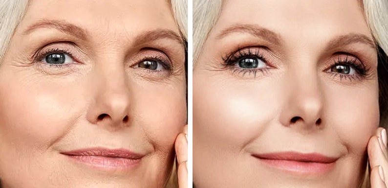 Professional Photo Retouching Service, Expert Digital Artist, Skin ...