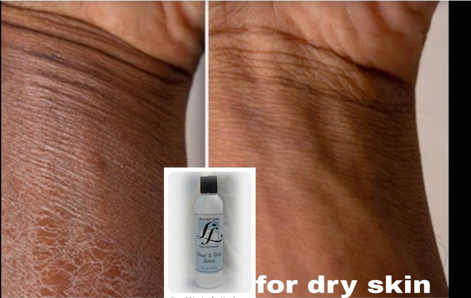 Emu Lotion for Dry Skin- Hand and Body Lotion 8oz. - Etsy