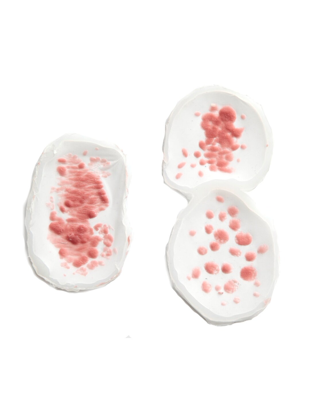 Psoriasis Wounds / Silicone Prosthetic / Halloween Prosthetic / Latex ...