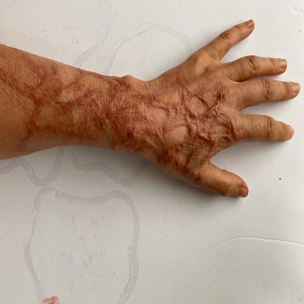 Burns Kit 1 Silicone Prosthetic Freddy Krueger Cosplay - Etsy Canada