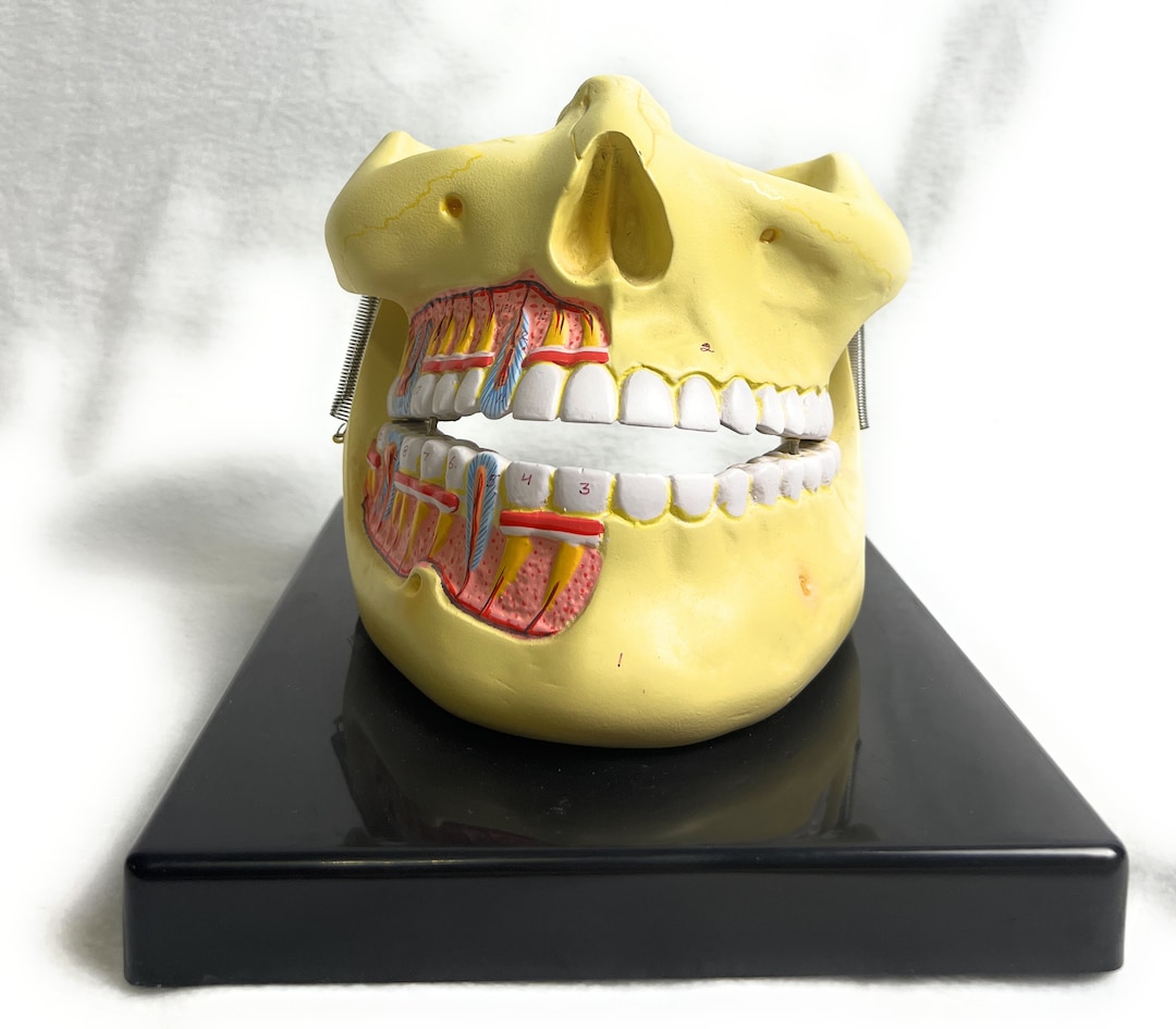 Adult Jaw upper and Lower Model Dental Anatomy - Etsy