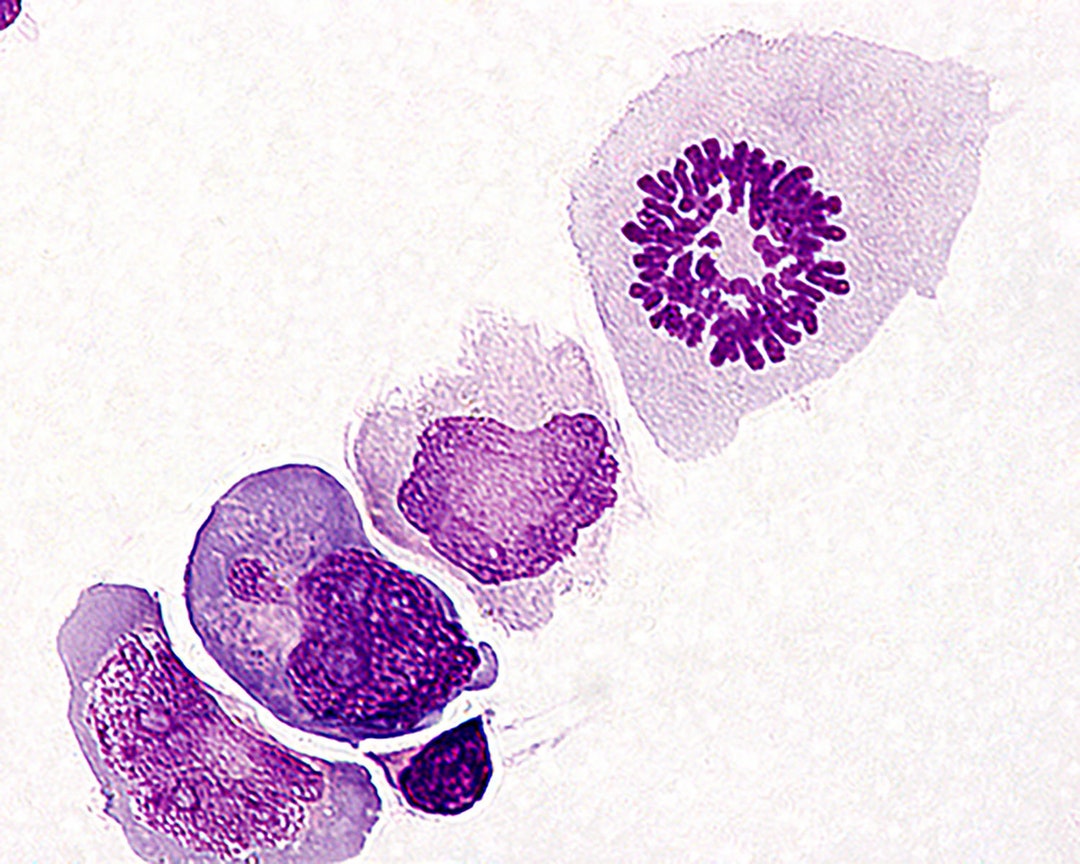 Mitotic Figure - Etsy