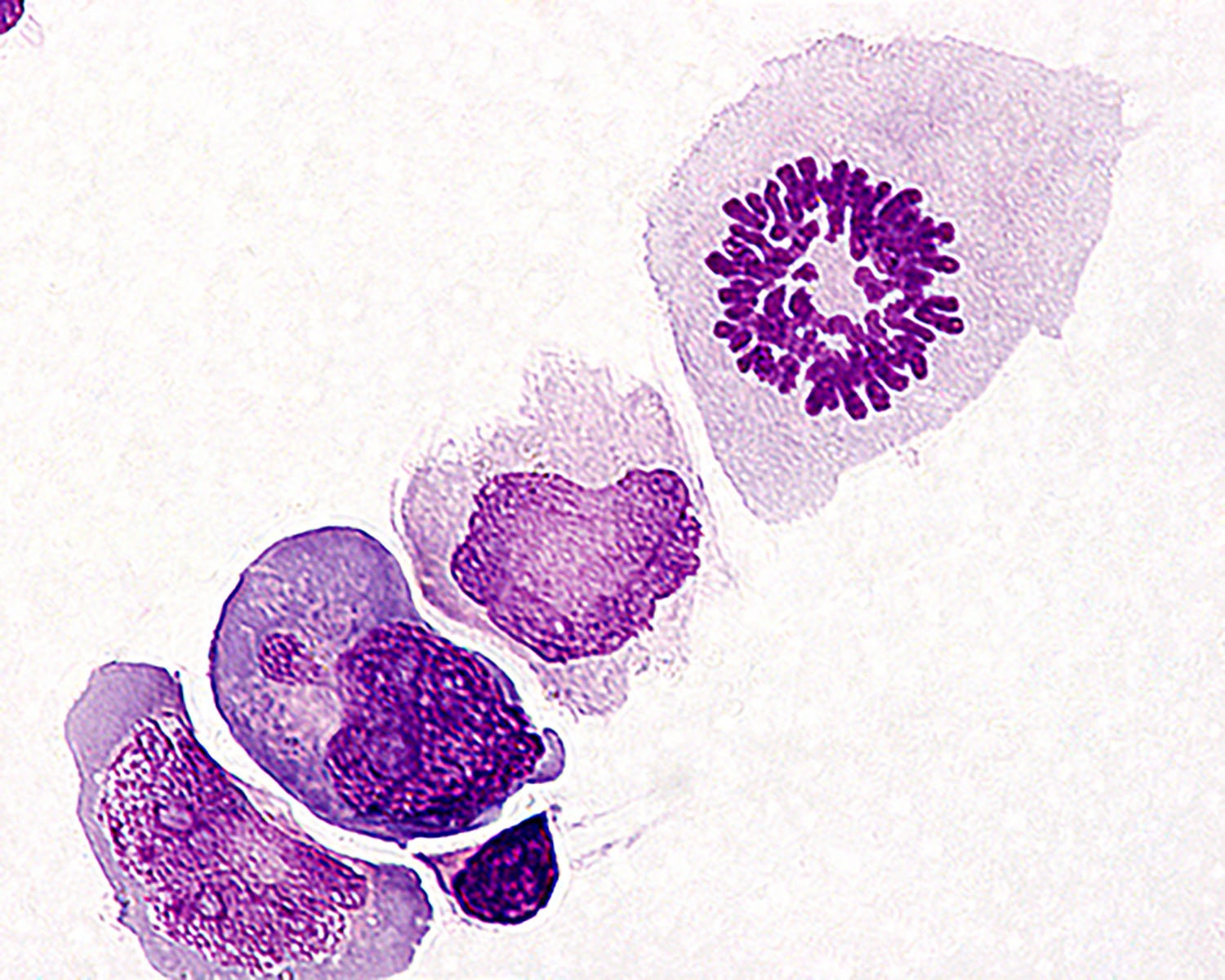 Mitotic Figure - Etsy