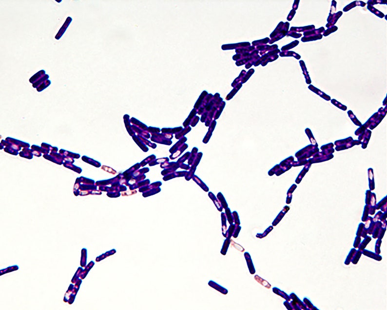 Bacillus Species, Gram Stain - Etsy