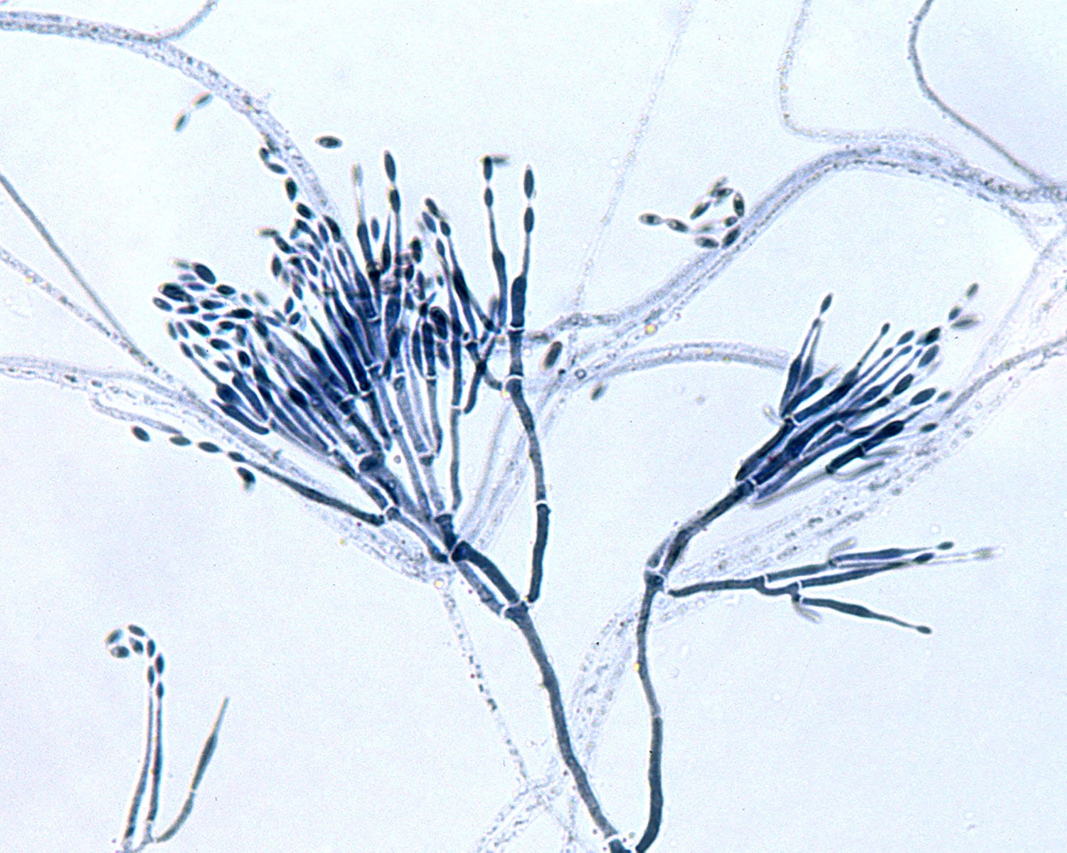 Paecilomyces