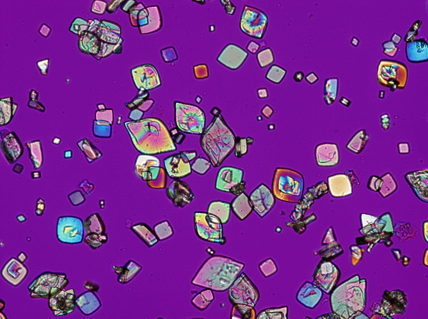 Uric Acid Crystals, Red Compensator - Etsy