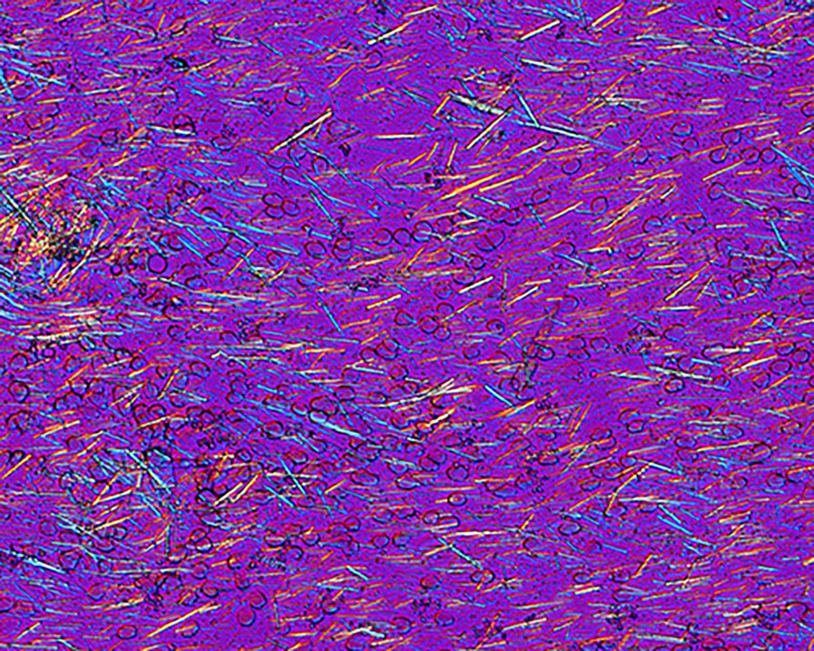 Monosodium Urate (MSU) Crystals - Etsy