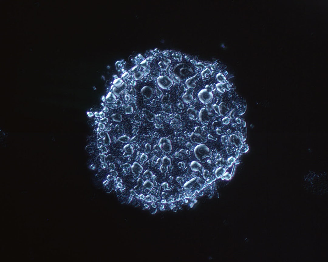 Oval Fat Bodies, Polarized Light - Etsy