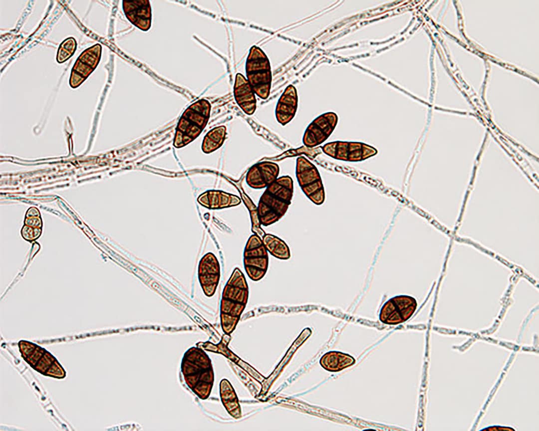 Ulocladium - Etsy Italia