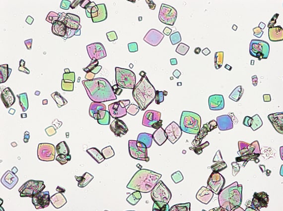 Polarized Light Microscopy Crystals
