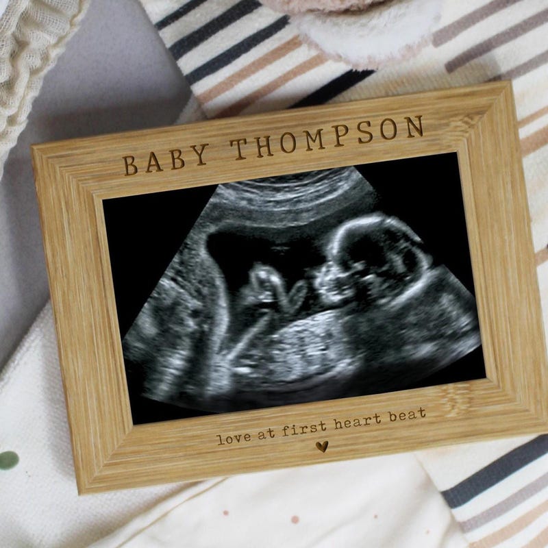 Ultra Sound Scan Frame - Etsy UK