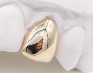 Single Gold Tooth - Etsy