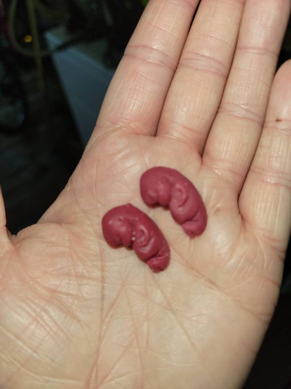 Baby Born At 8 Weeks