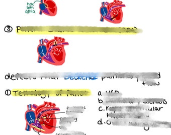 Cardiac Study Guide Bundle CHF CAD Angina Myocardial Infarction I ACS ...