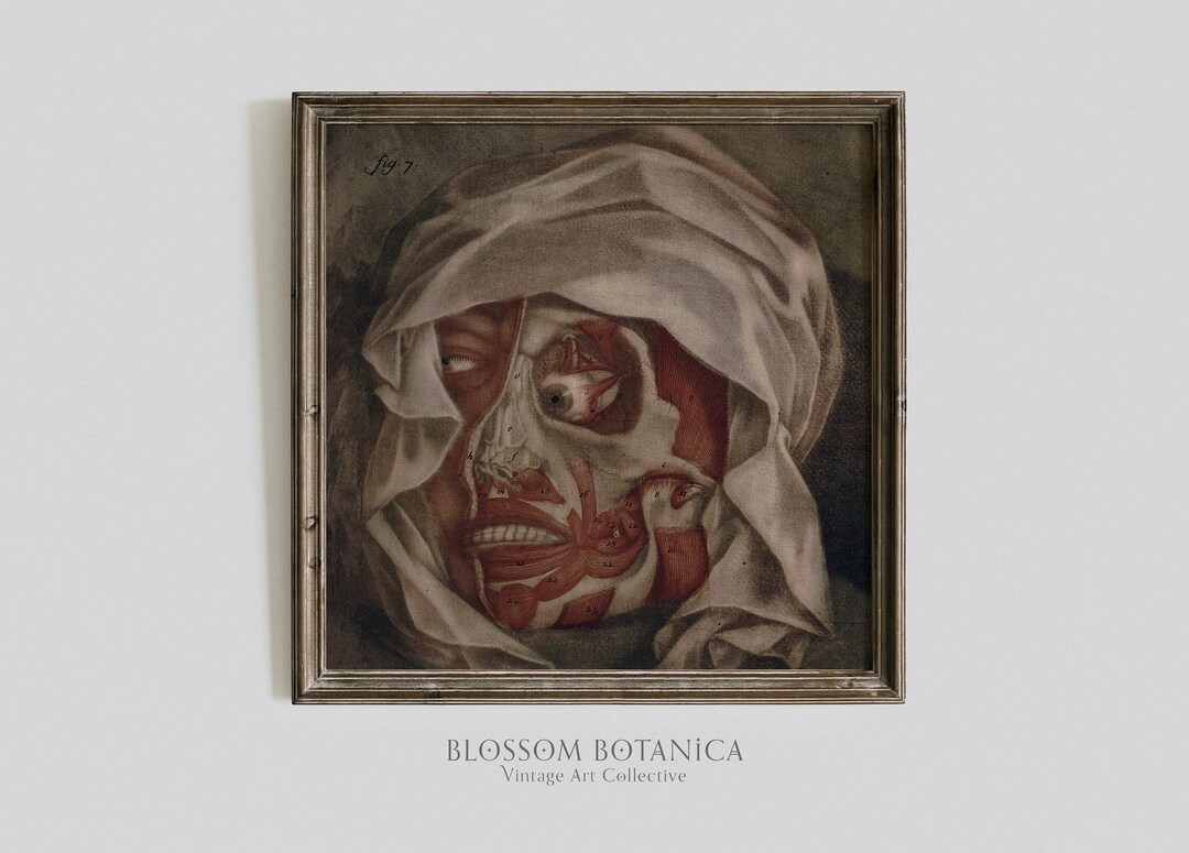 Moody Medical Anatomy Art, Dark Gothic Skeletal Print, Jacques-fabien ...