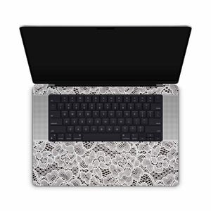 French Lace MacBook Case: Dual Layer Skin and Clear Hardshell - Etsy