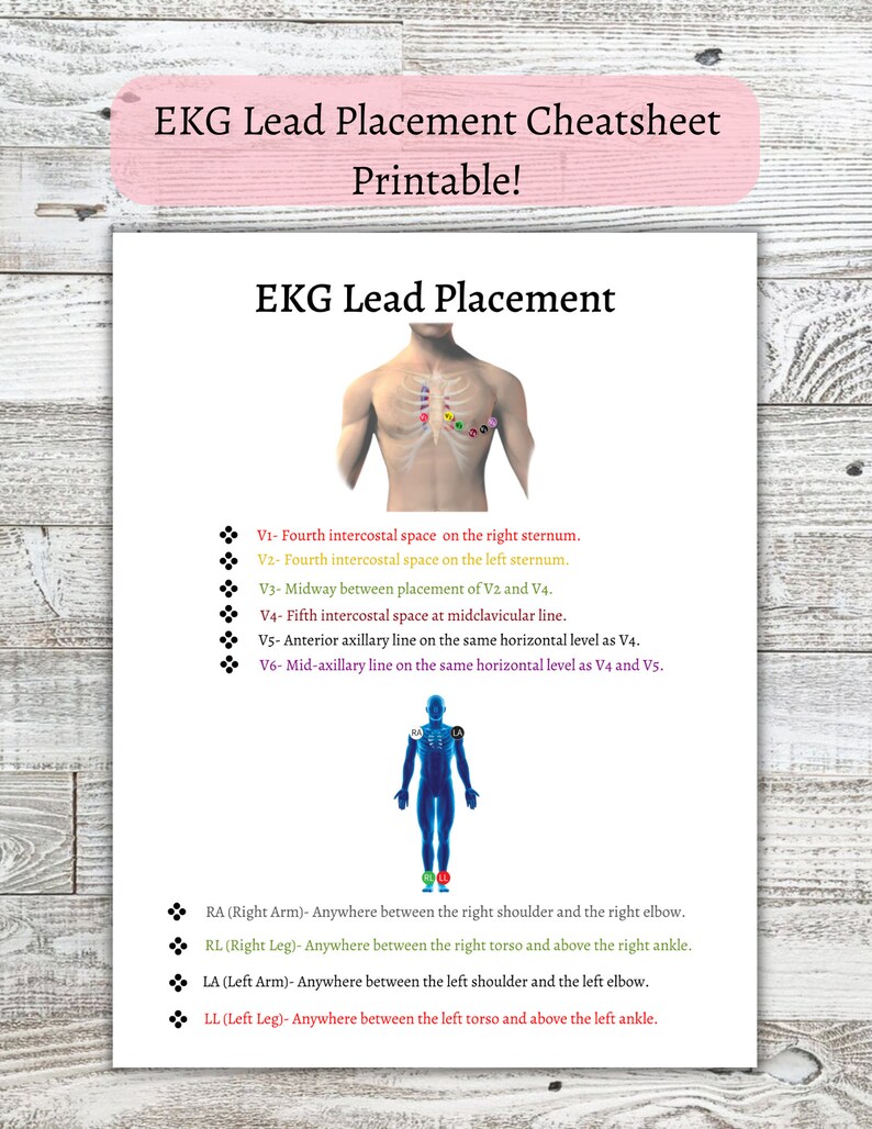 Ekg Lead Placements Printable Cheatsheet Poster Us Letter Etsy