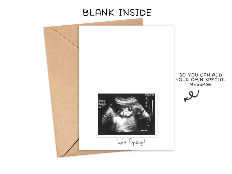 Printable Pregnancy Announcement Card: Sonogram Reveal (PDF) - Etsy