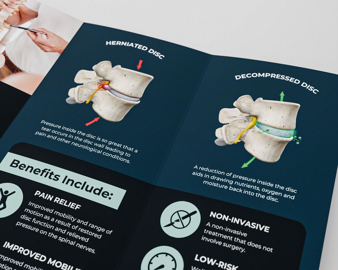 SPINAL DECOMPRESSION Brochure - Etsy