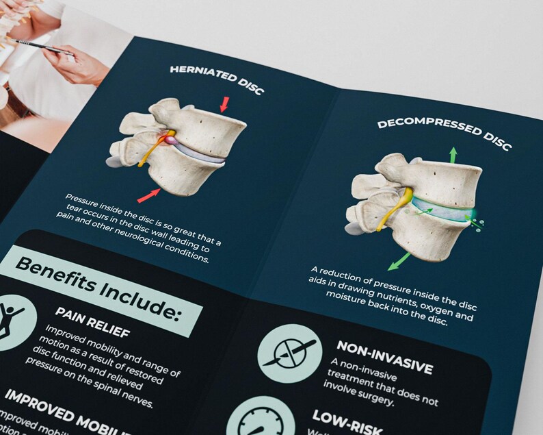 SPINAL DECOMPRESSION Brochure - Etsy