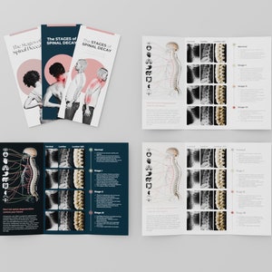 STAGES of SPINAL DECAY Brochure - Etsy