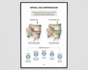 SPINAL DECOMPRESSION Brochure - Etsy
