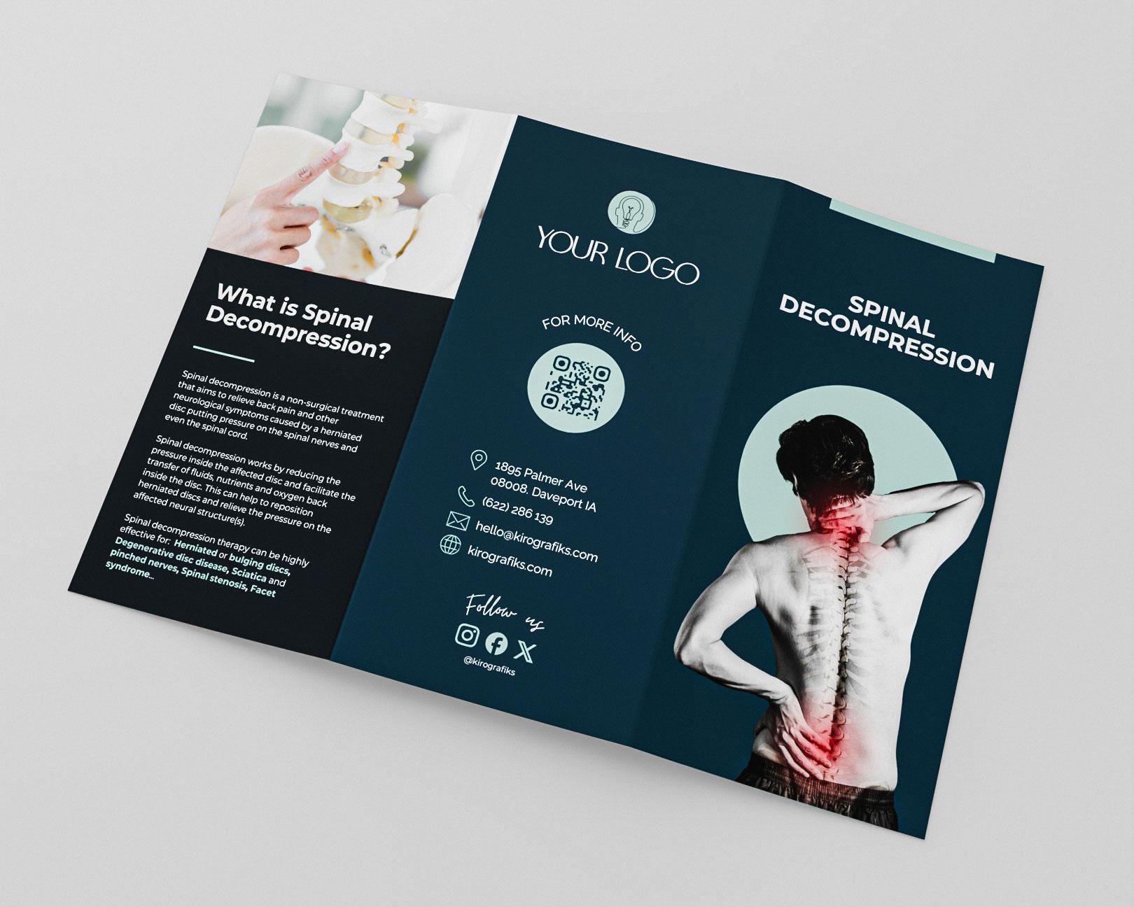 SPINAL DECOMPRESSION Brochure - Etsy