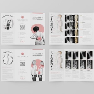 STAGES of SPINAL DECAY Brochure - Etsy
