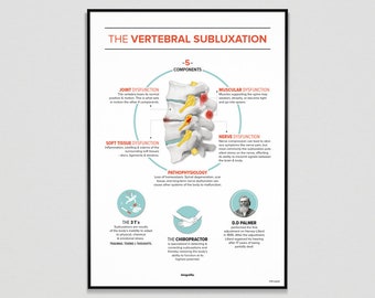 Vertebral Subluxation and Nerve Chart Poster - Etsy UK