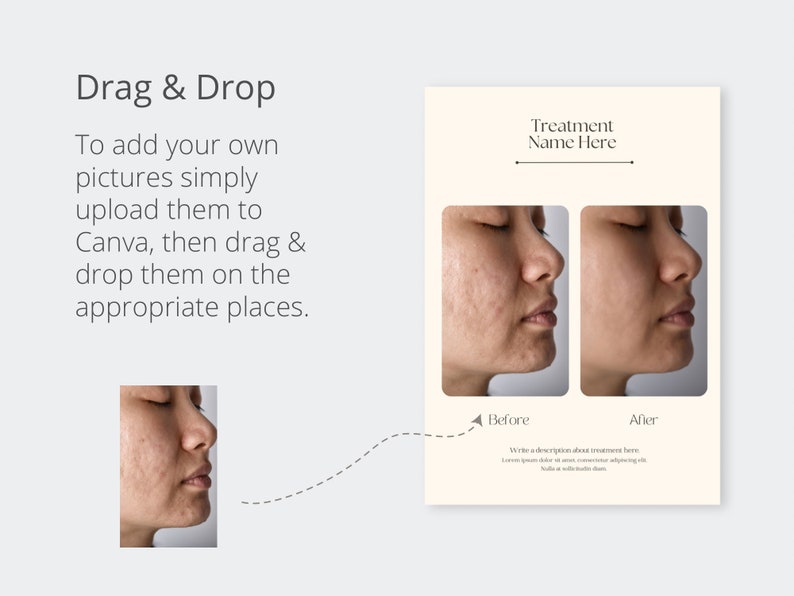 Patient Guidebook for Injectable Treatments. Client Booklet. Editable ...