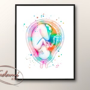 In Vitro Fertilization Art IVF Poster Fetus in Womb Print Fertility ...