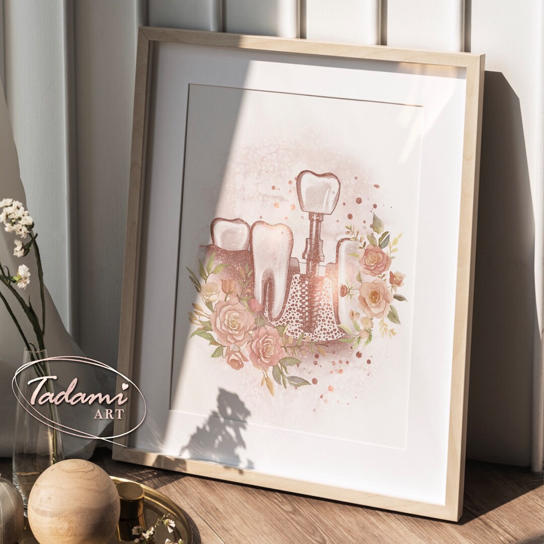 Dental Poster, Dental Implant Art , Dental Clinic Decor, Tooth Anatomy ...