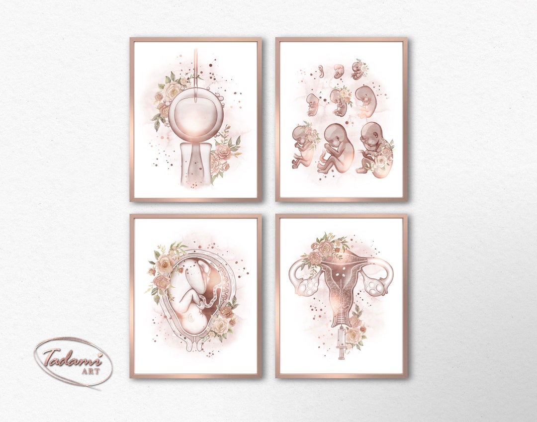 IVF Poster, Fertility Wall Art. Gynecology Print, In Vitro ...