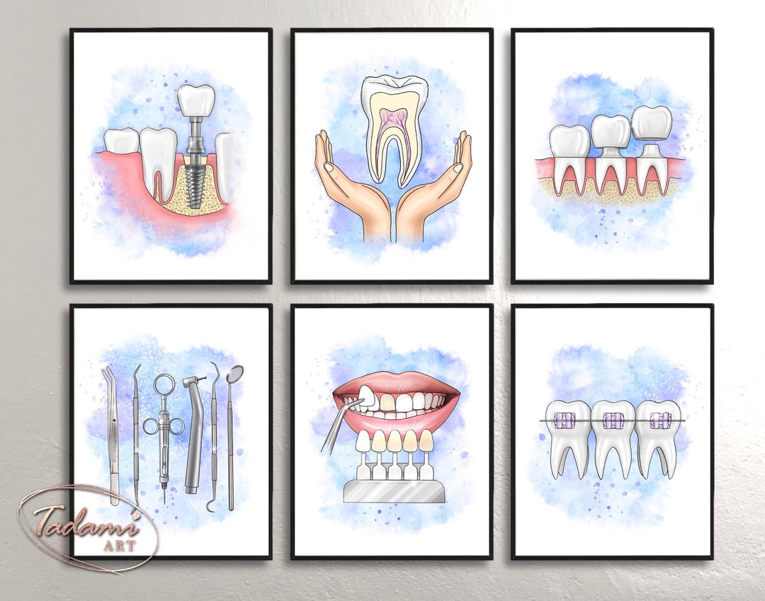 6 Dental Poster Tooth Art Watercolor Dentist Room Decor Dental Print ...