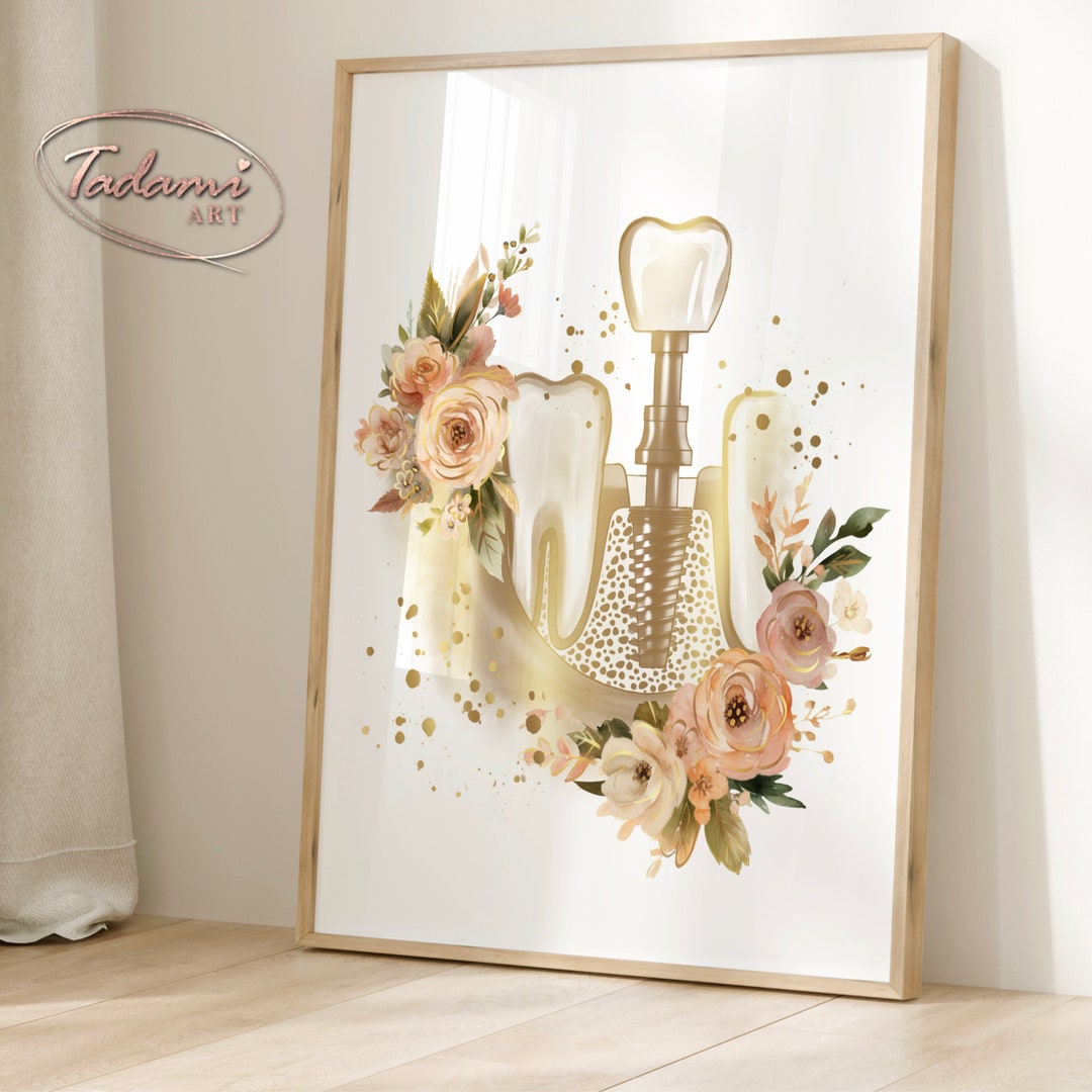Dental Poster, Dental Implant Art, Orthodontist Gift, Tooth Implant ...