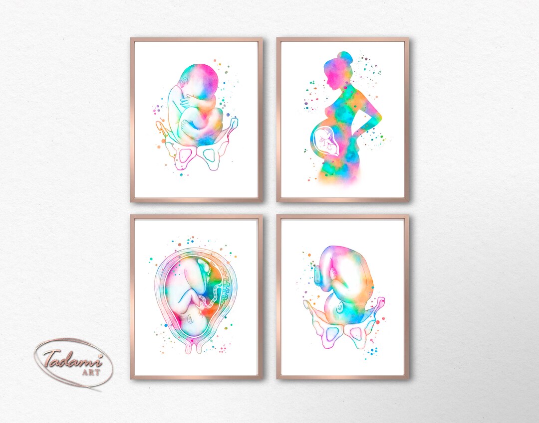 Fetal Presentation Art Pregnancy Anatomy Poster Fetus - Etsy