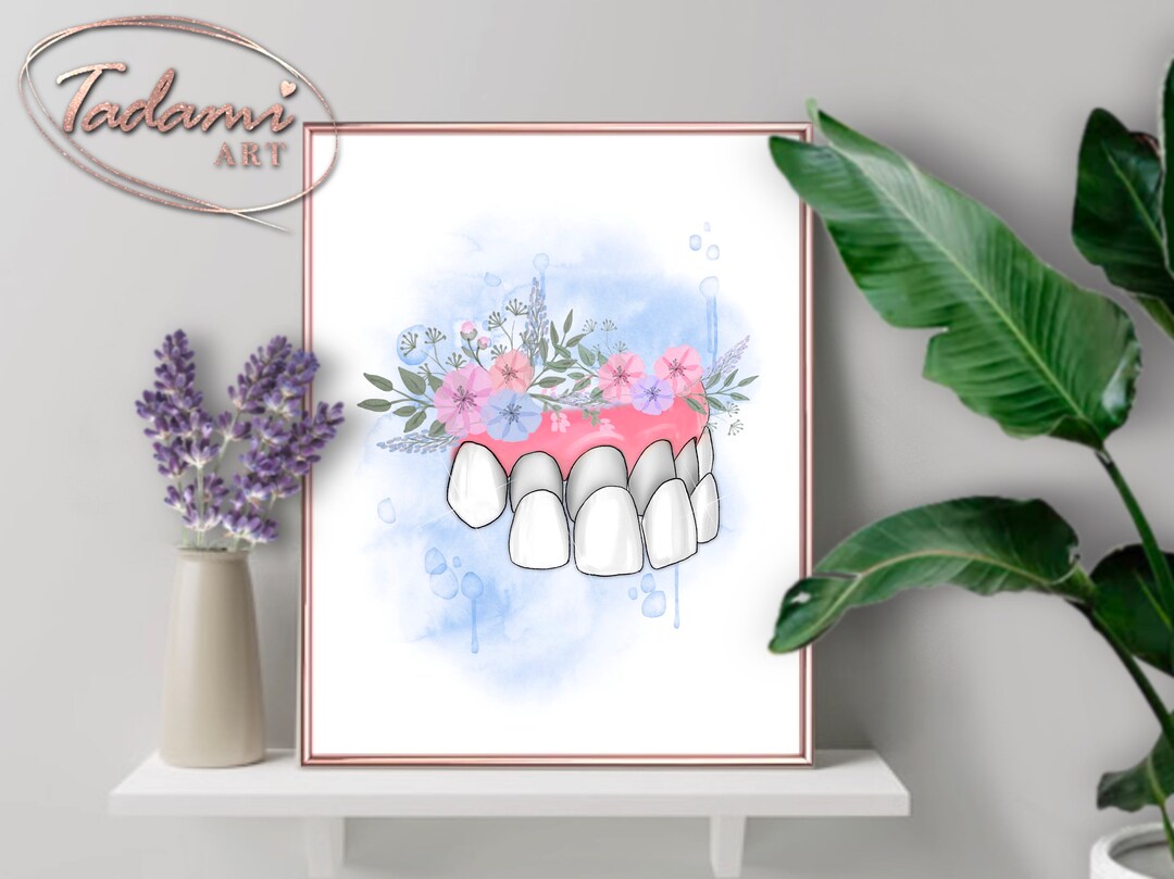 Dental Veneers Poster Instant Download Aesthetic Dentistry Art ...