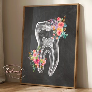 Tooth Anatomy Art, Dental Poster, Tooth Chalk Board Art, Dentist Gift ...