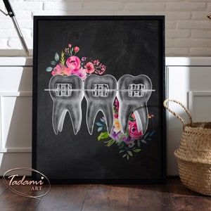 Braces Poster, Dental Wall Art, Tooth Anatomy Print, Dentist Gift ...