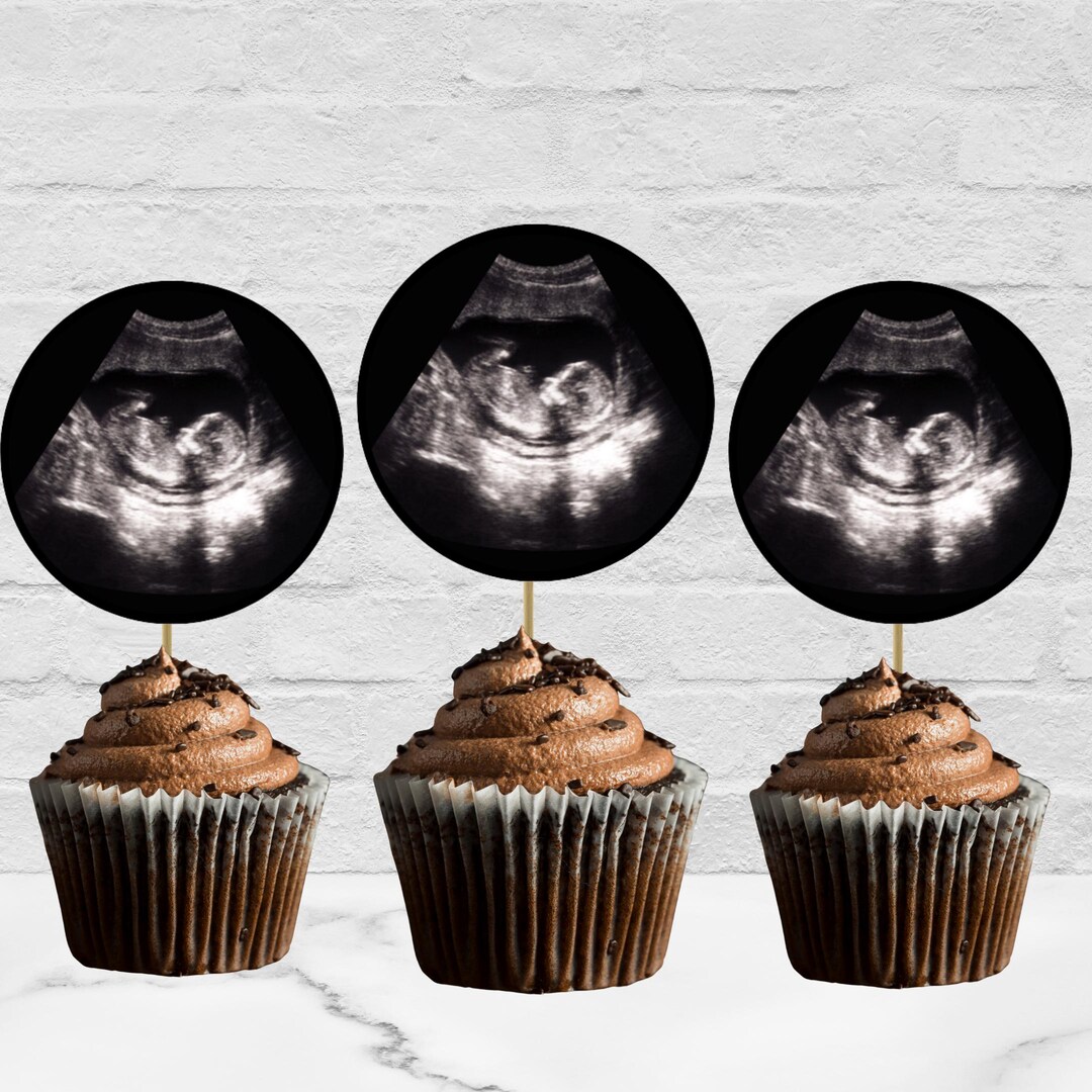 Baby Ultrasound Digital Printable Cupcake Toppers, Instant Download ...