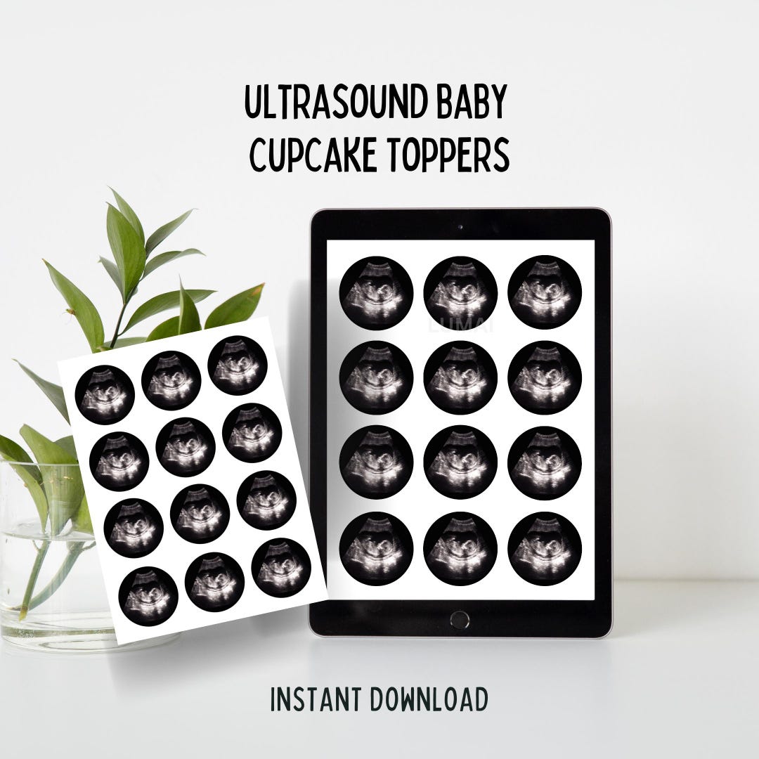 Baby Ultrasound Digital Printable Cupcake Toppers, Instant Download ...