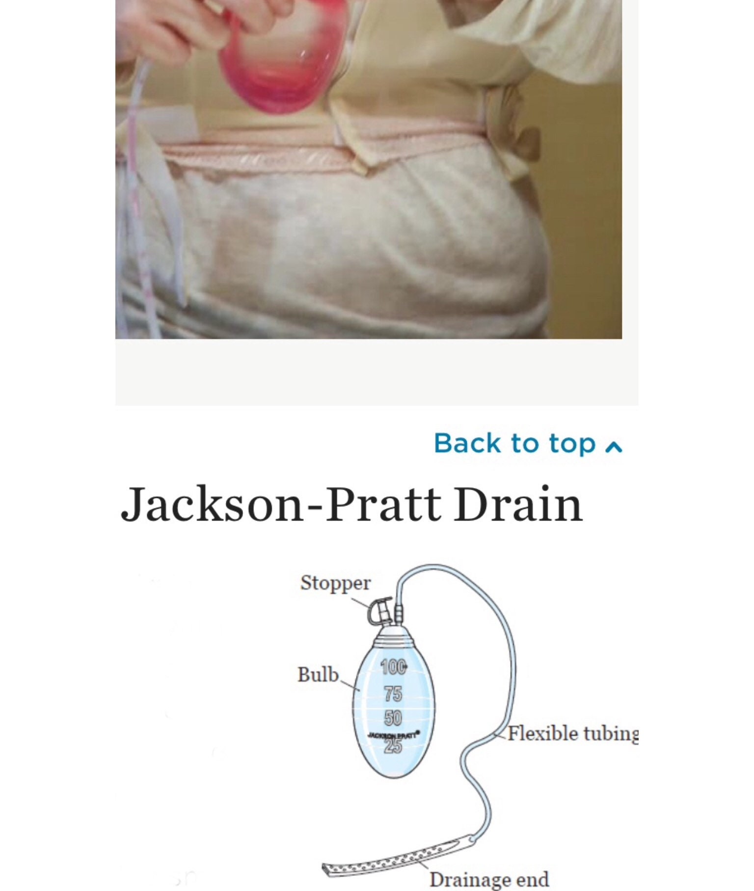 Jackson Pratt Drain Illustration