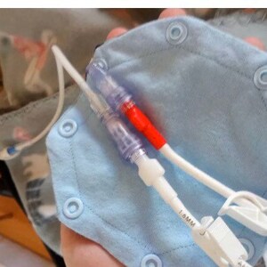 5 NGT Enteral Feeding Tube Connection Port IV Peg J-tube JEJ Hickman ...