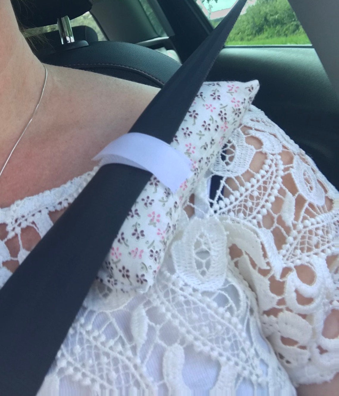 SLNB Single Mastectomy Breast Lumpectomy Mammoplasty Augmentation ...