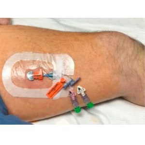 Femoral Line - Polka Dot -central Venous Catheter CVC Bag / Pouch for ...