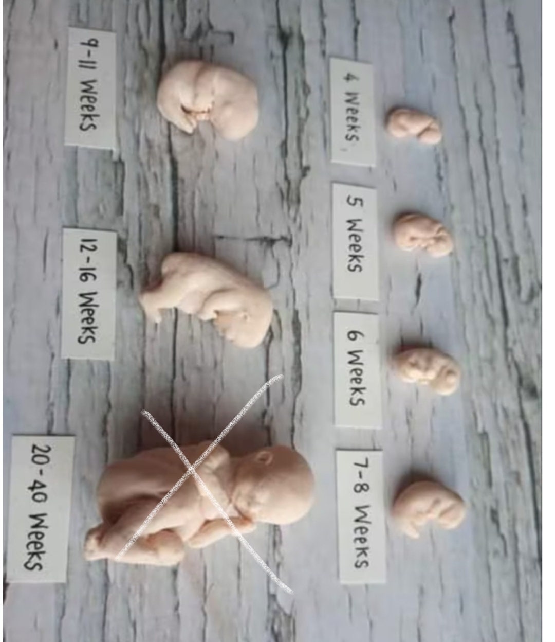 Baby Fetus Mold- Baby Silicone Molds- Gestation Molds- Gestational Ages ...