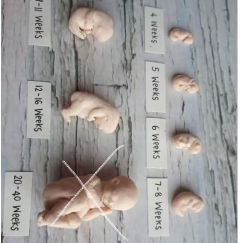 Fetus Doll - Etsy